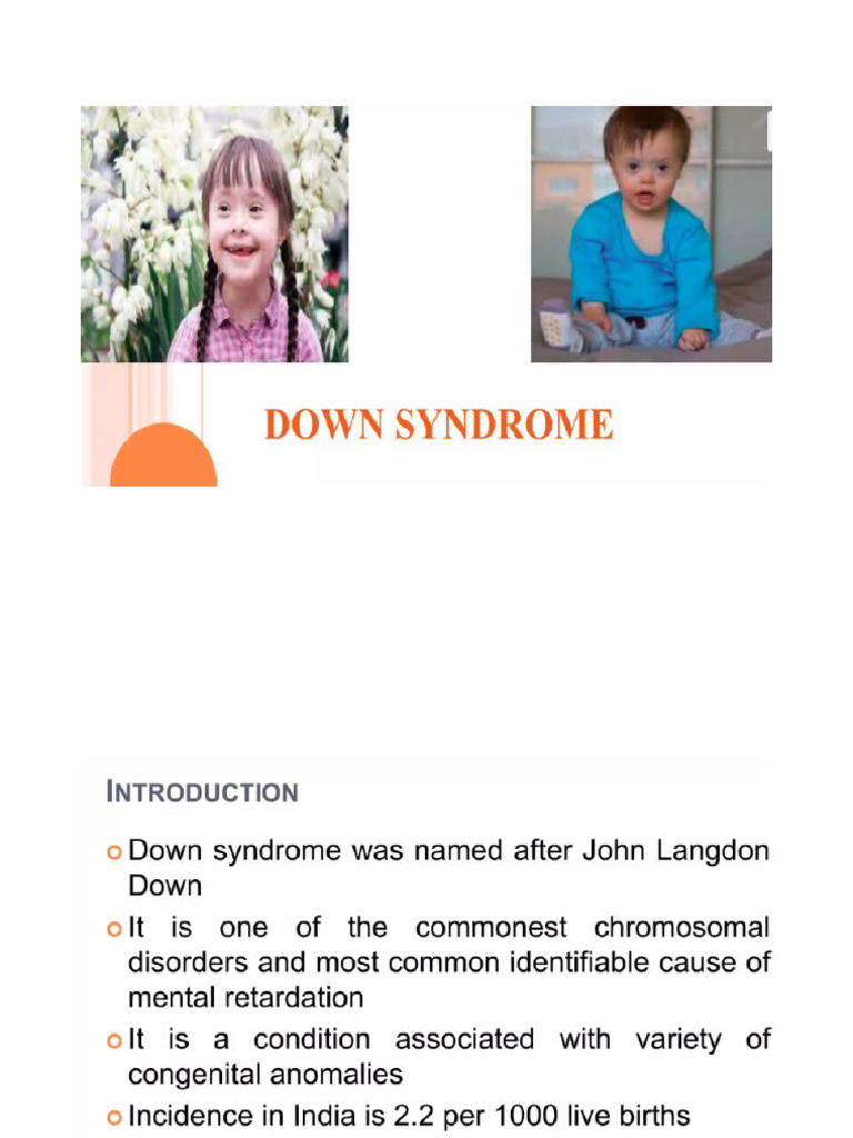 Down Syndrome | PDF