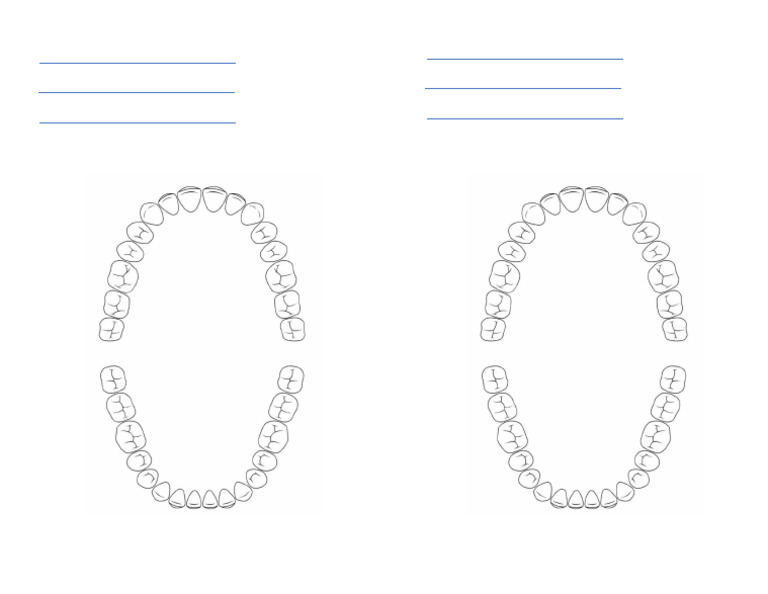 RPD Design Sheet | PDF