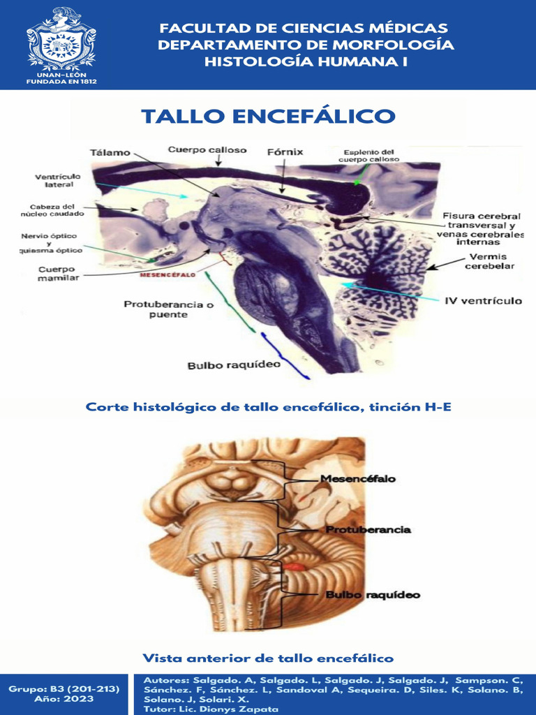 Banner de Tallo Encefálico-1 | PDF