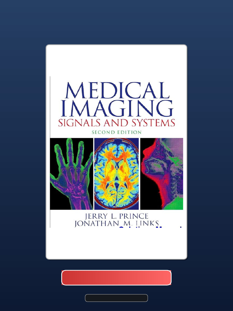 Medical Imaging Signals and Systems 2nd Edition Prince Ebook and ...