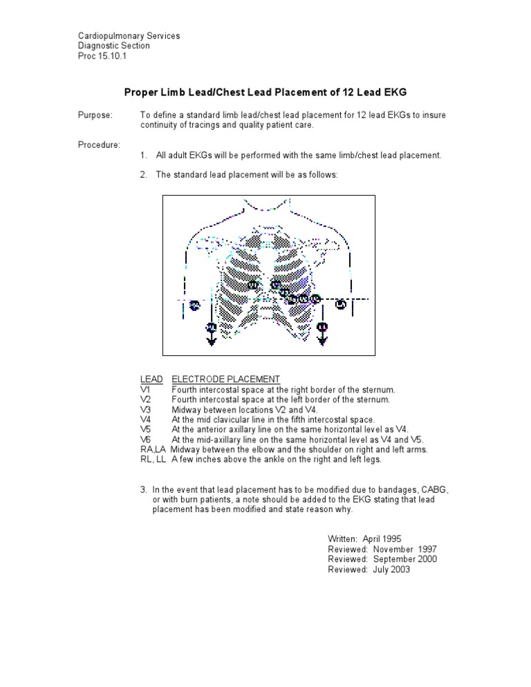 12 Lead EKG Limb/Chest Lead Placement Guide | PDF