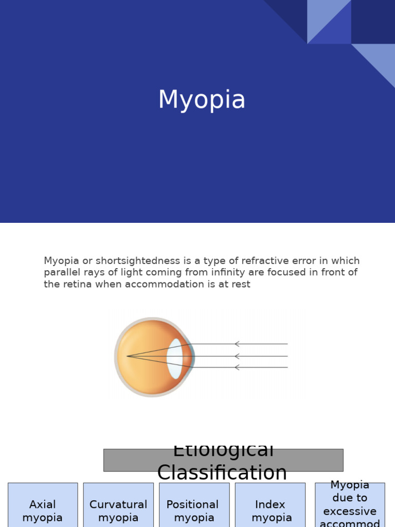 Understanding Myopia: Types and Causes | PDF