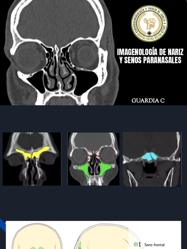 Imagenologia de Nariz y Senos Paranasales | PDF | Nariz humana | Rinología