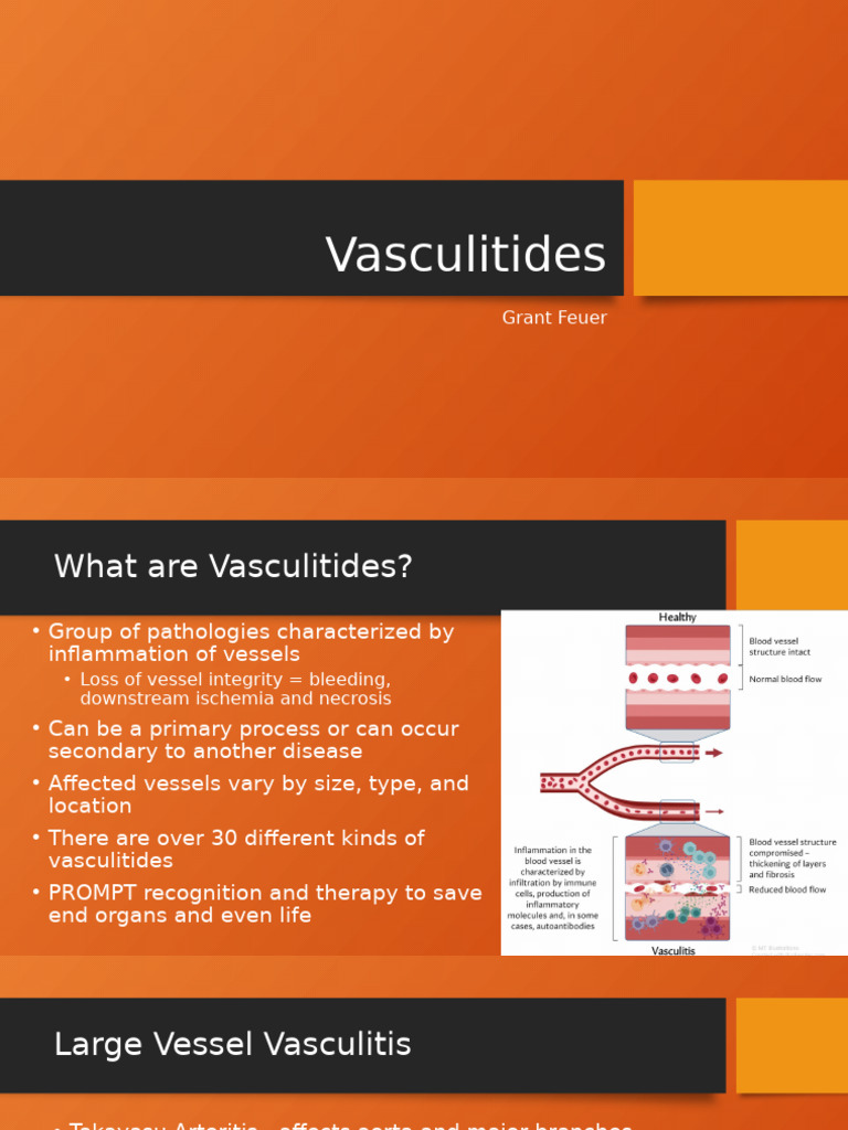 Vasculitis Presentation | PDF | Diseases And Disorders | Medical ...