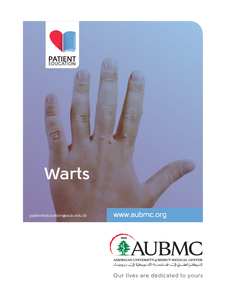 Warts | PDF