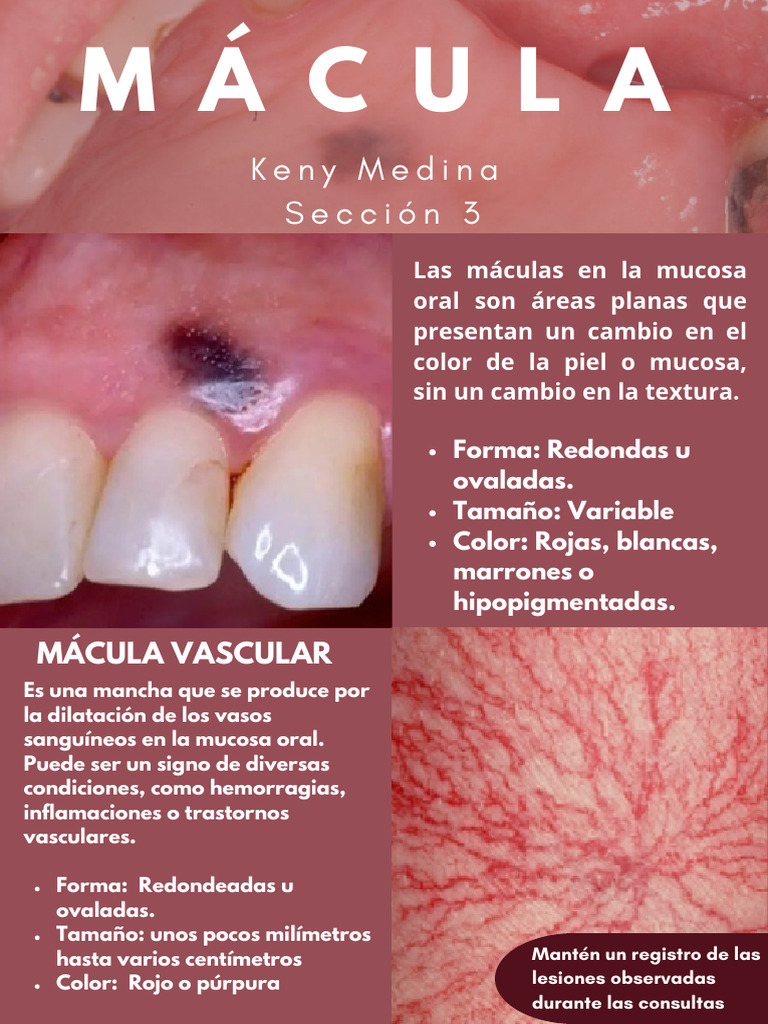 Macula | PDF