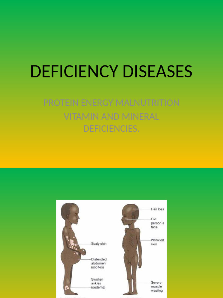 Deficiency Diseases - Pharm Sarah | PDF | Malnutrition | Nutrients