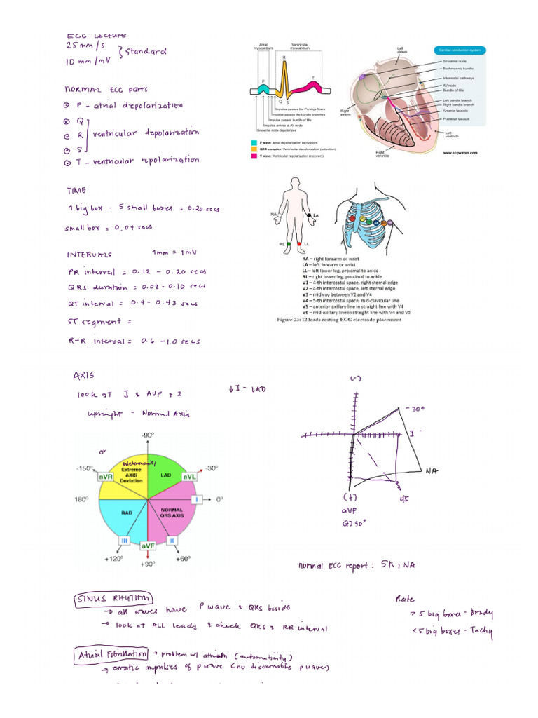 ECG Lecture | PDF