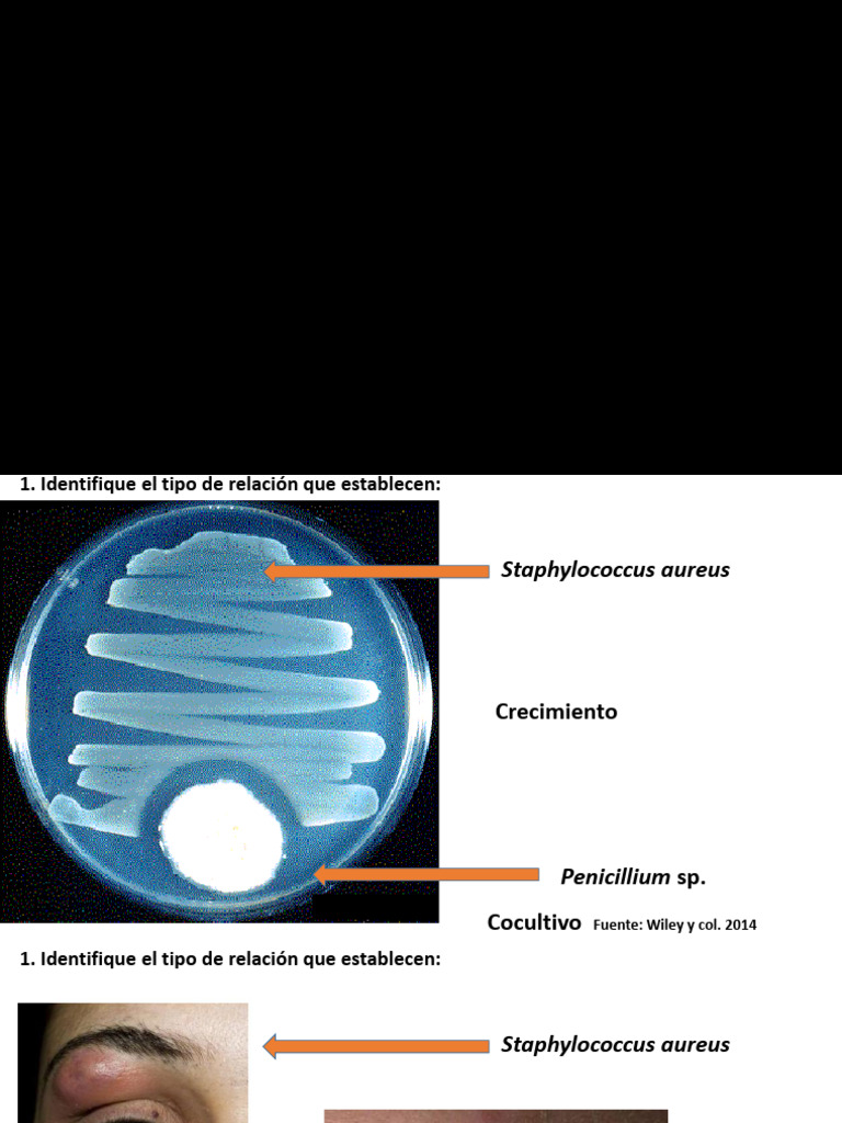 Métodos de Control Microbiano y Bioseguridad | PDF | Esterilización ...