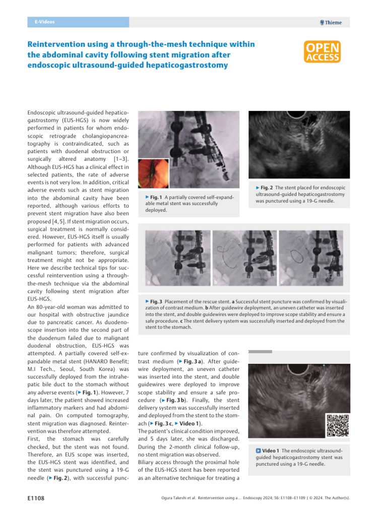 Reintervention Using A Through The Mesh Technique Within The Abdominal ...