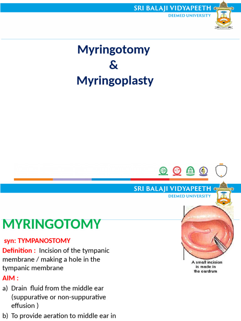 Myringoplasty and Myringotomy | PDF | Ear | Medical Specialties