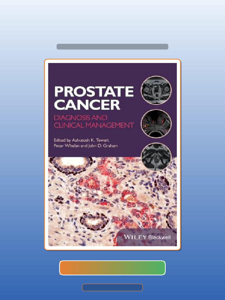 Prostate Cancer Diagnosis and Clinical Management Ebook and TestBank ...