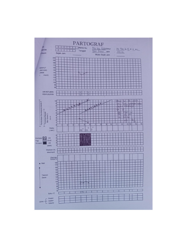 Parto 1 | PDF