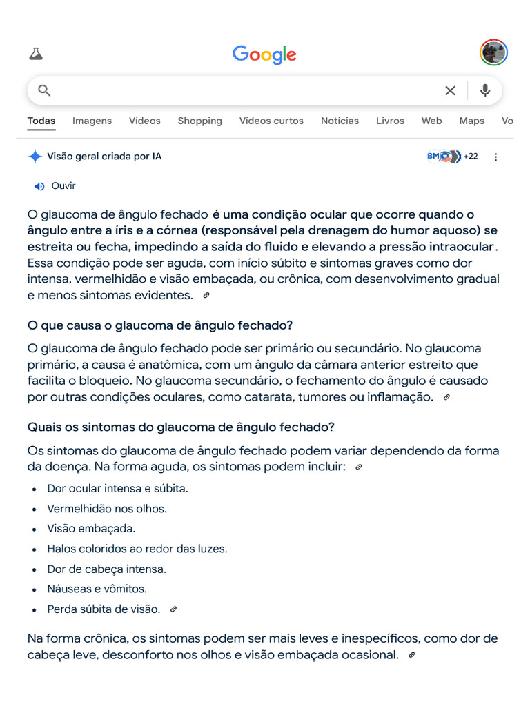 Glaucoma de Angulo Fechado - Pesquisa Google | PDF | Glaucoma | Sistema ...