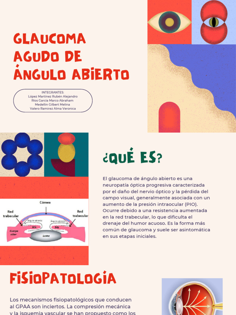 Glaucoma Agudo de Ángulo Abierto | PDF | Glaucoma | Ojo humano