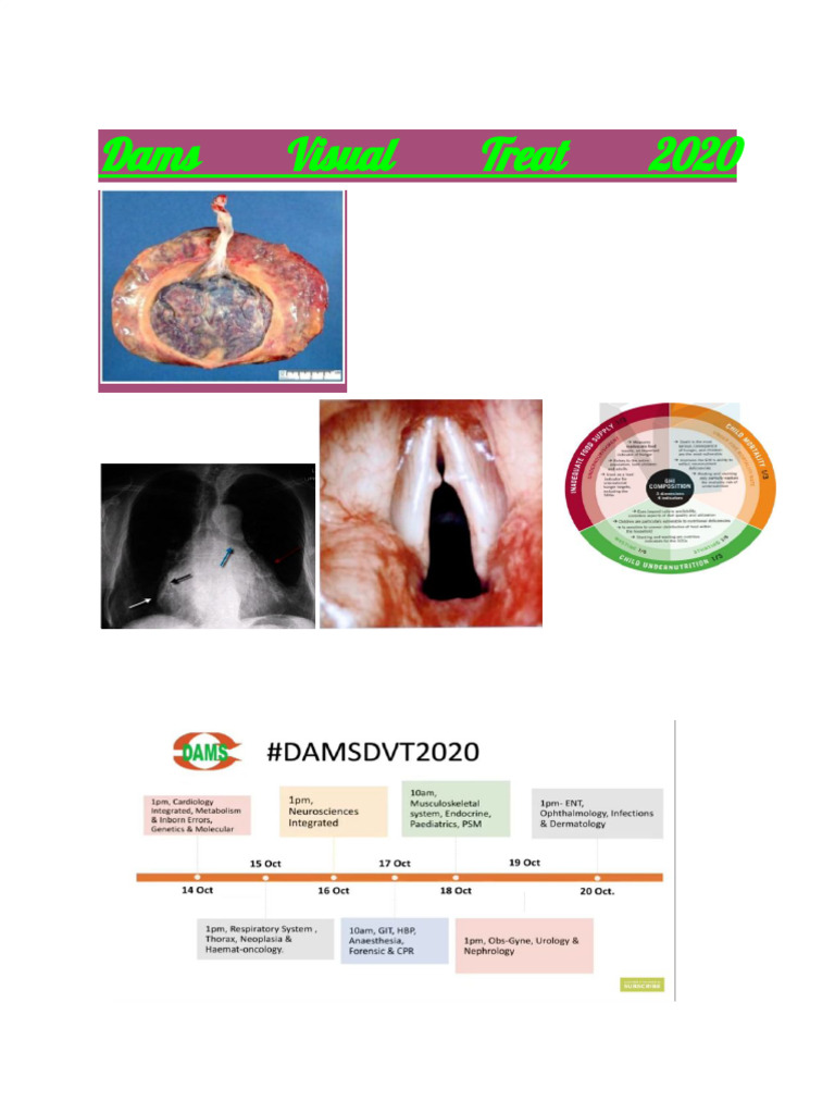 Dams DVT All Integrated | PDF | Pneumonia | Meningitis