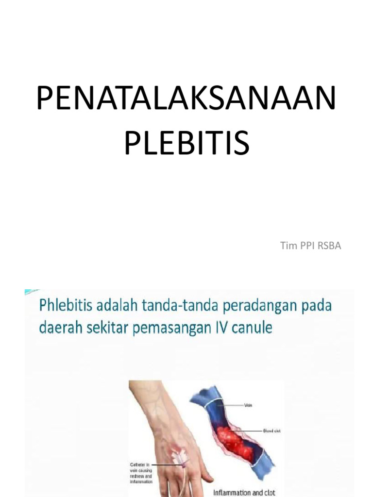 Penatalaksanaan Plebitis | PDF
