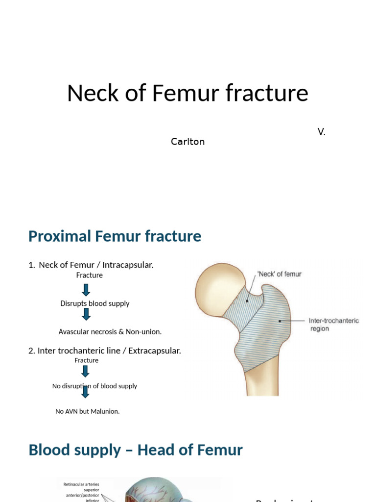 Neck of Femur Fracture | PDF | Hip | Anatomical Terms Of Motion