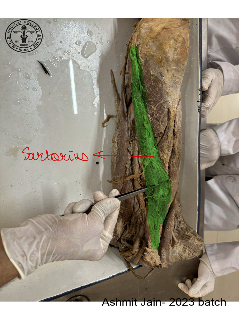 Lower Limb Dissection Overview | PDF
