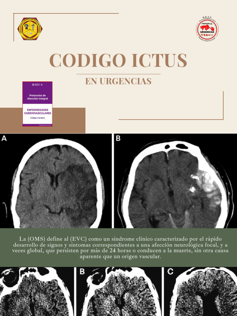 Protocolo de Código Ictus en Urgencias | PDF | Carrera | Enfermedades y ...