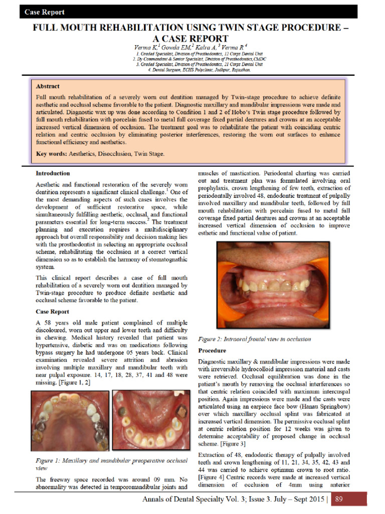 Full Mouth Rehabilitation Using Twin Stage Procedure A Case Report | PDF
