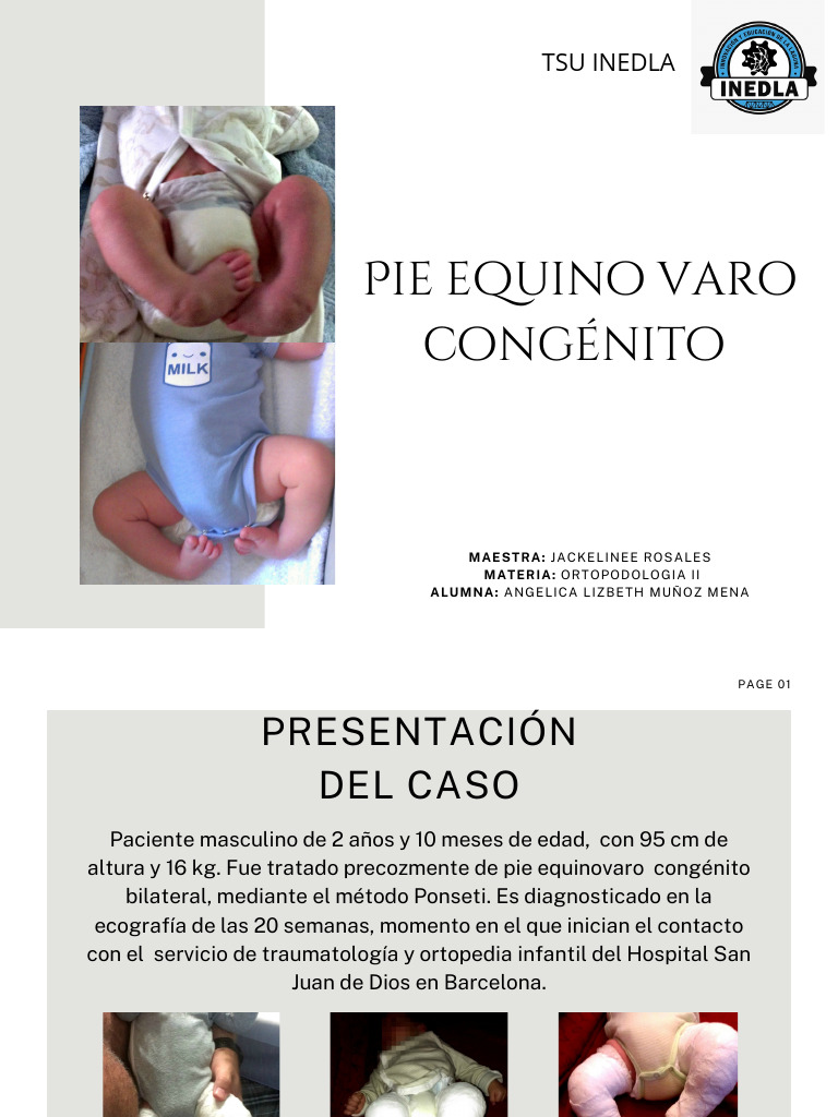 Tratamiento del Pie Equinovaro Congénito | PDF | Especialidades Medicas ...