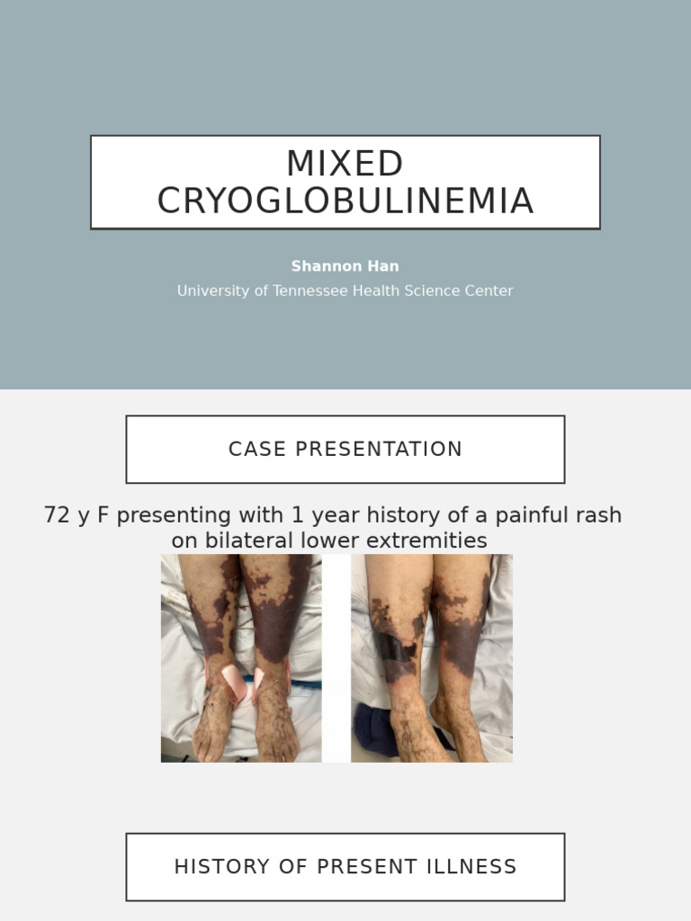Cryoglobulinemia Presentation | PDF | Diseases And Disorders | Medical ...