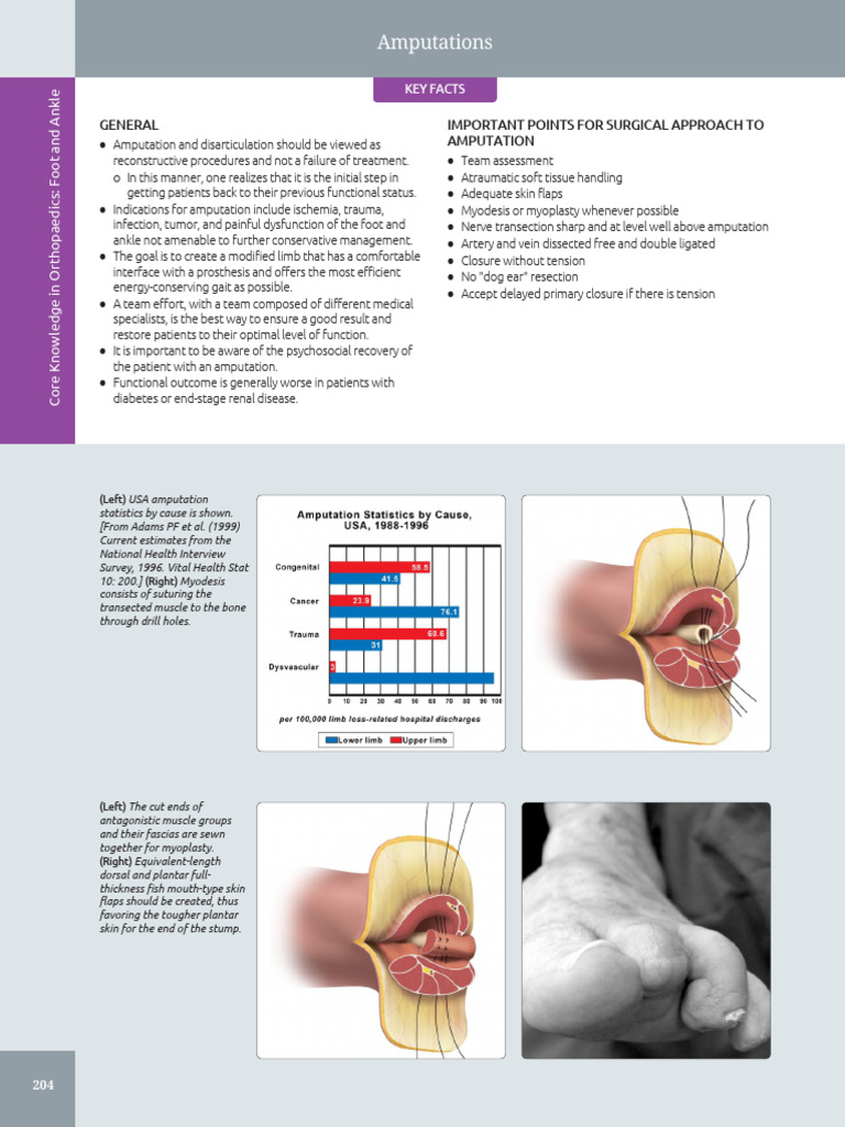 Amputations-Myodesis & Myoplasty | PDF | Amputation | Prosthesis