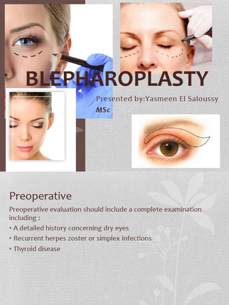 Preoperative Blepharoplasty Evaluation Guide | PDF | Human Eye ...