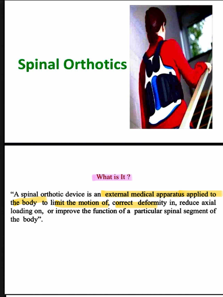 Spinal Orthotics | PDF