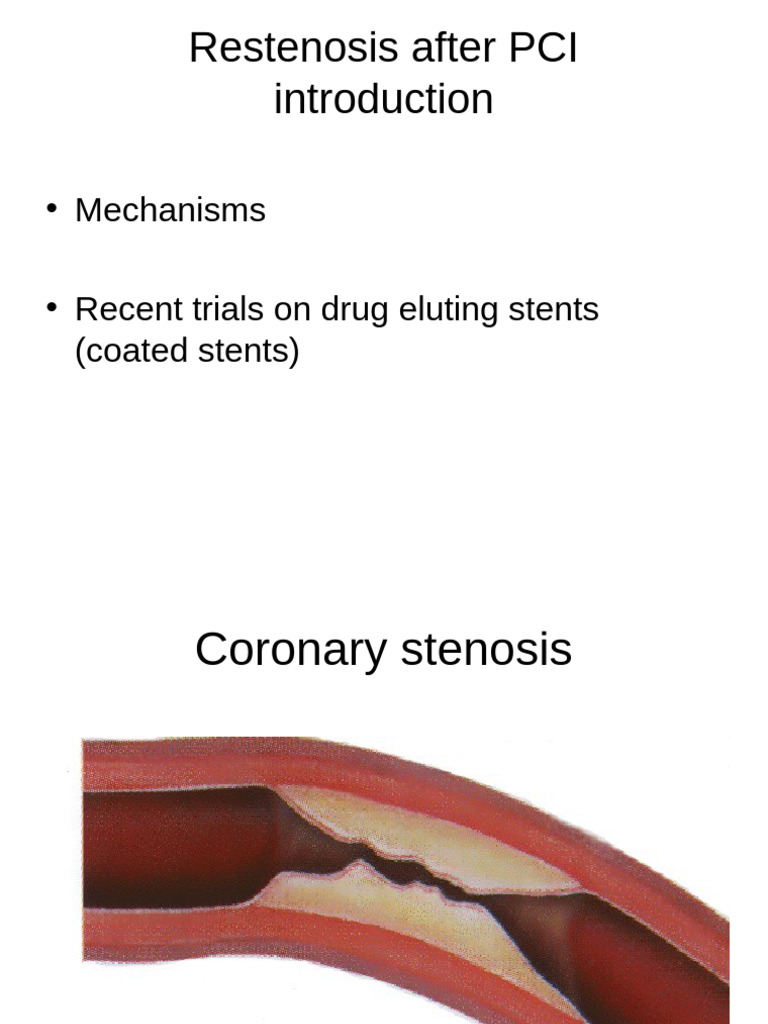Restenosis After PCI: Mechanisms & Solutions | PDF | Percutaneous ...