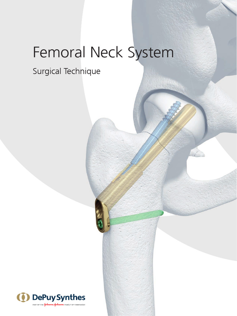 Femoral Neck System Synthes | PDF | Magnetic Resonance Imaging | Screw