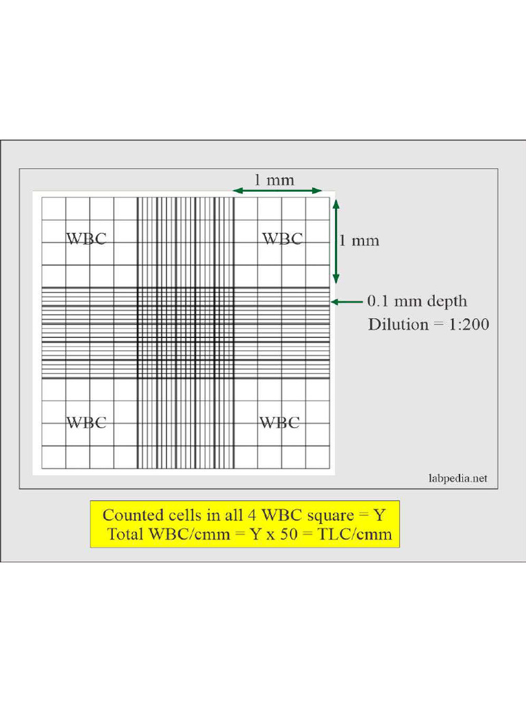 WBC TLC Counting | PDF