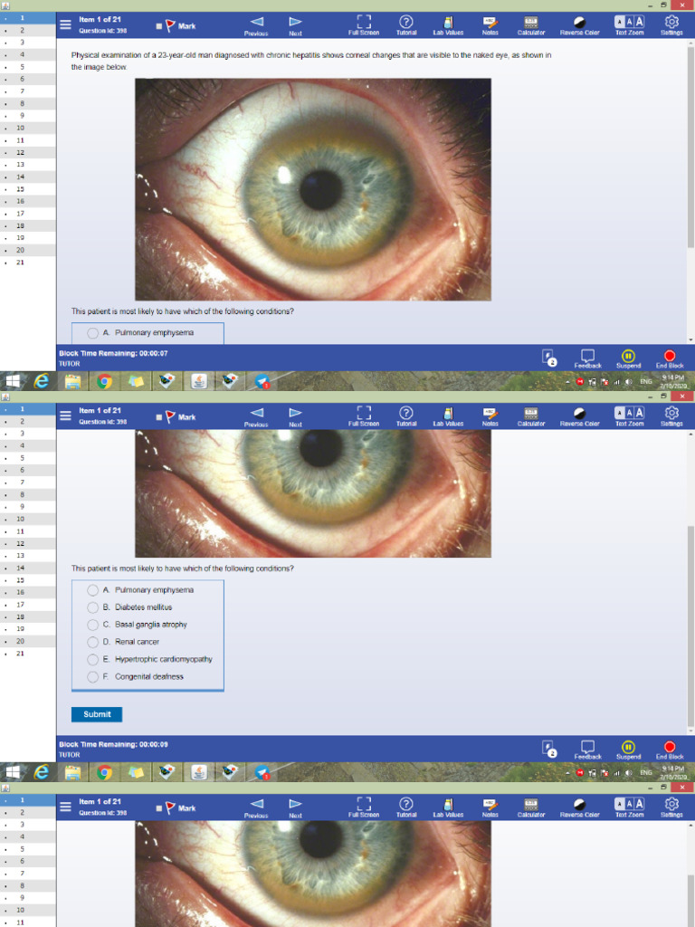 Ophthalmology Block 1 Step 1 Uworld 2020 | PDF