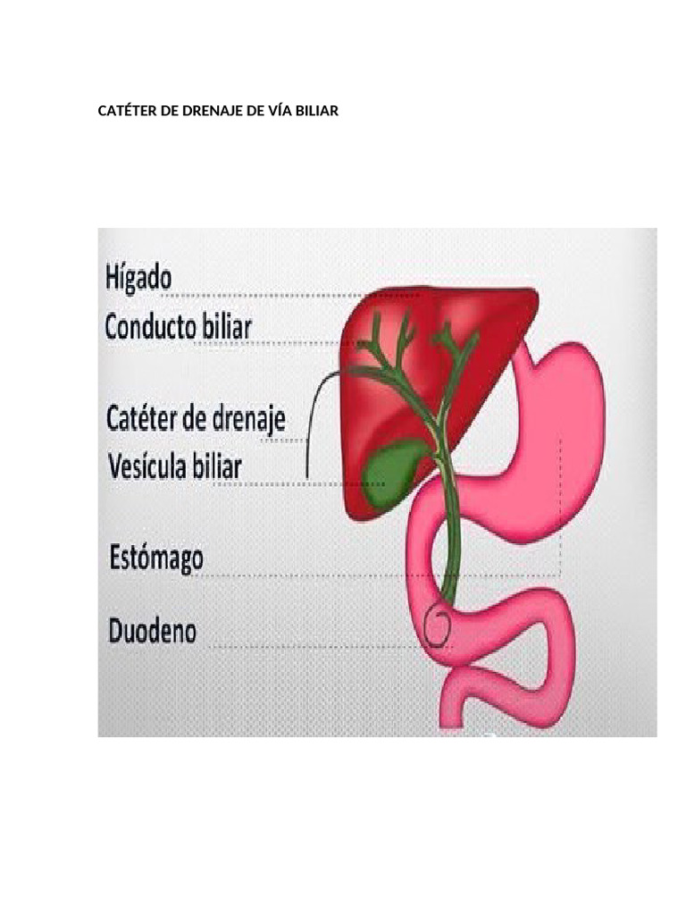 Drenaje de La Vía Biliar | PDF