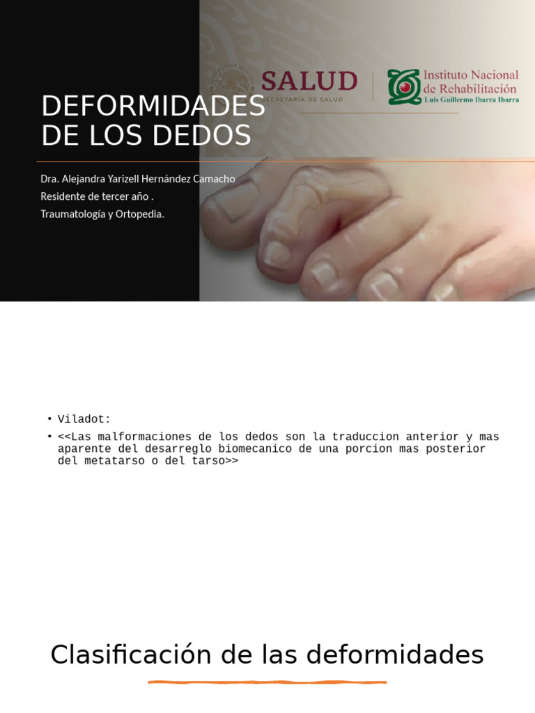 Deformidades de los dedos del pie | PDF | Dedo del pie | Pie