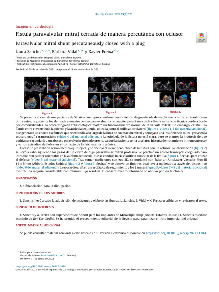 Fistula Paravalvular Mitral Cerrada de Manera Percutanea Con Oclusor ...