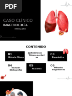 Angiotac para TEP: Protocolo y Hallazgos | PDF | Infarto de miocardio ...