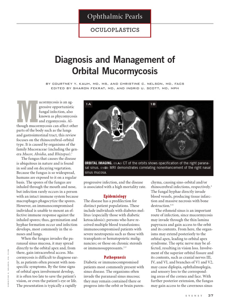 June 2014 Ophthalmic Pearls | PDF | Medical Specialties | Diseases And Disorders