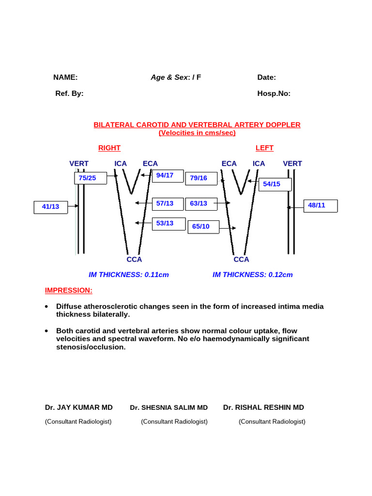 Bilateral Carotid & Vertebral Doppler Report | PDF