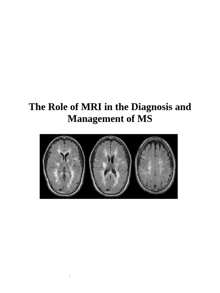 The Role of MRI in The Diagnosis and Management of MS | PDF | Multiple ...