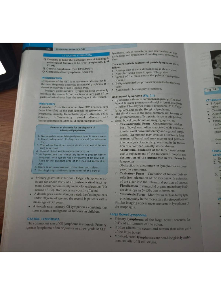 GI Lymphoma | PDF