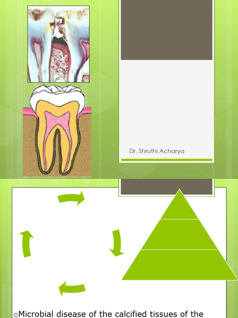 Rdiographic Interpretation of Caries | PDF | Tooth Enamel | Dentistry