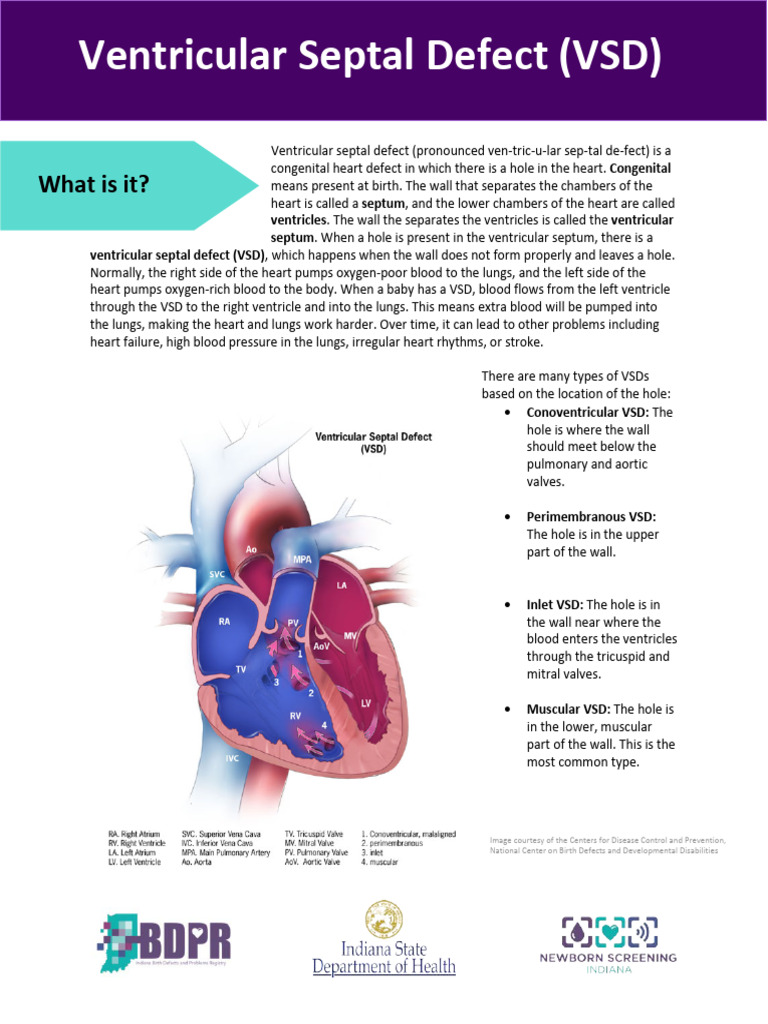 Understanding Ventricular Septal Defect | PDF | Ventricle (Heart ...