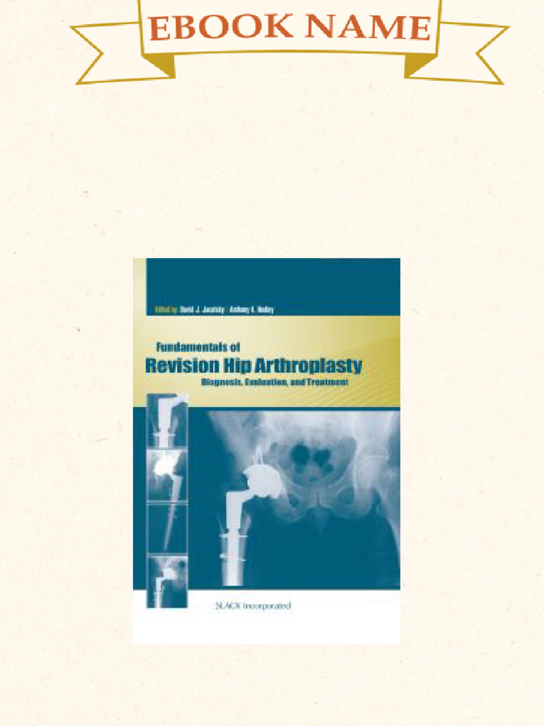 Fundamentals of Revision Hip Arthroplasty Diagnosis Evaluation and ...