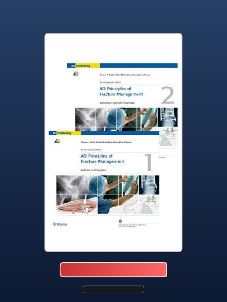 AO Principles of Fracture Management 2nd Test Bank Available Instantly ...