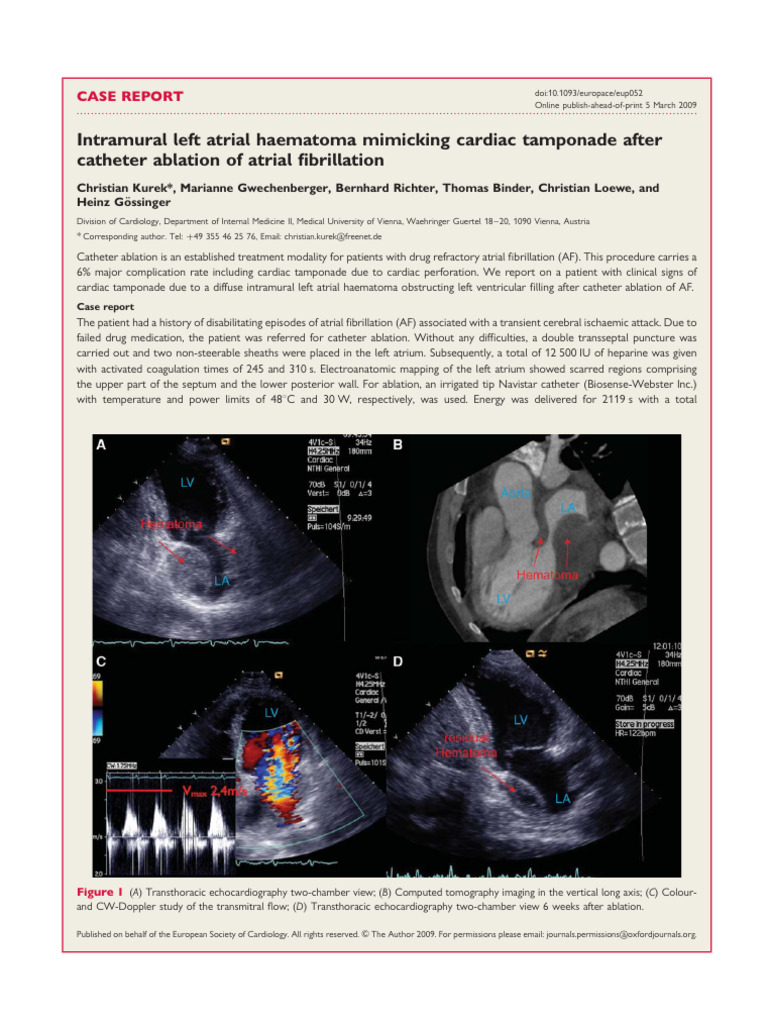 Binder Et Al. - 2009 - Intramural Left Atrial Haematoma Mimicking ...