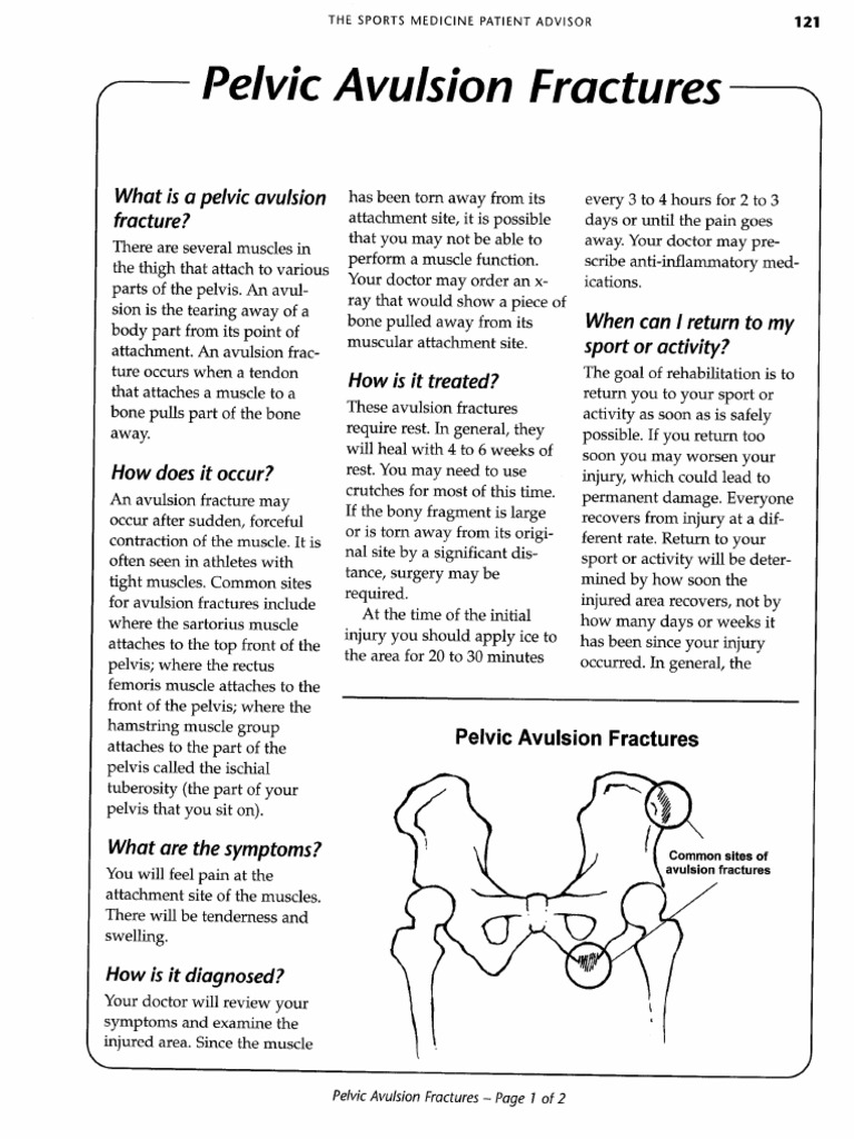 124 - Pelvic Avulsion Fracture | PDF