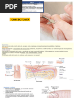Onicectomía: Procedimiento y Cuidados | PDF | Clavo (anatomía) | Dedo ...