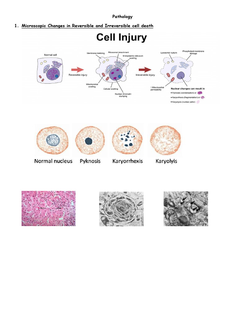Imp Topics Patho Unannotated | PDF | Immunology | Diseases And Disorders
